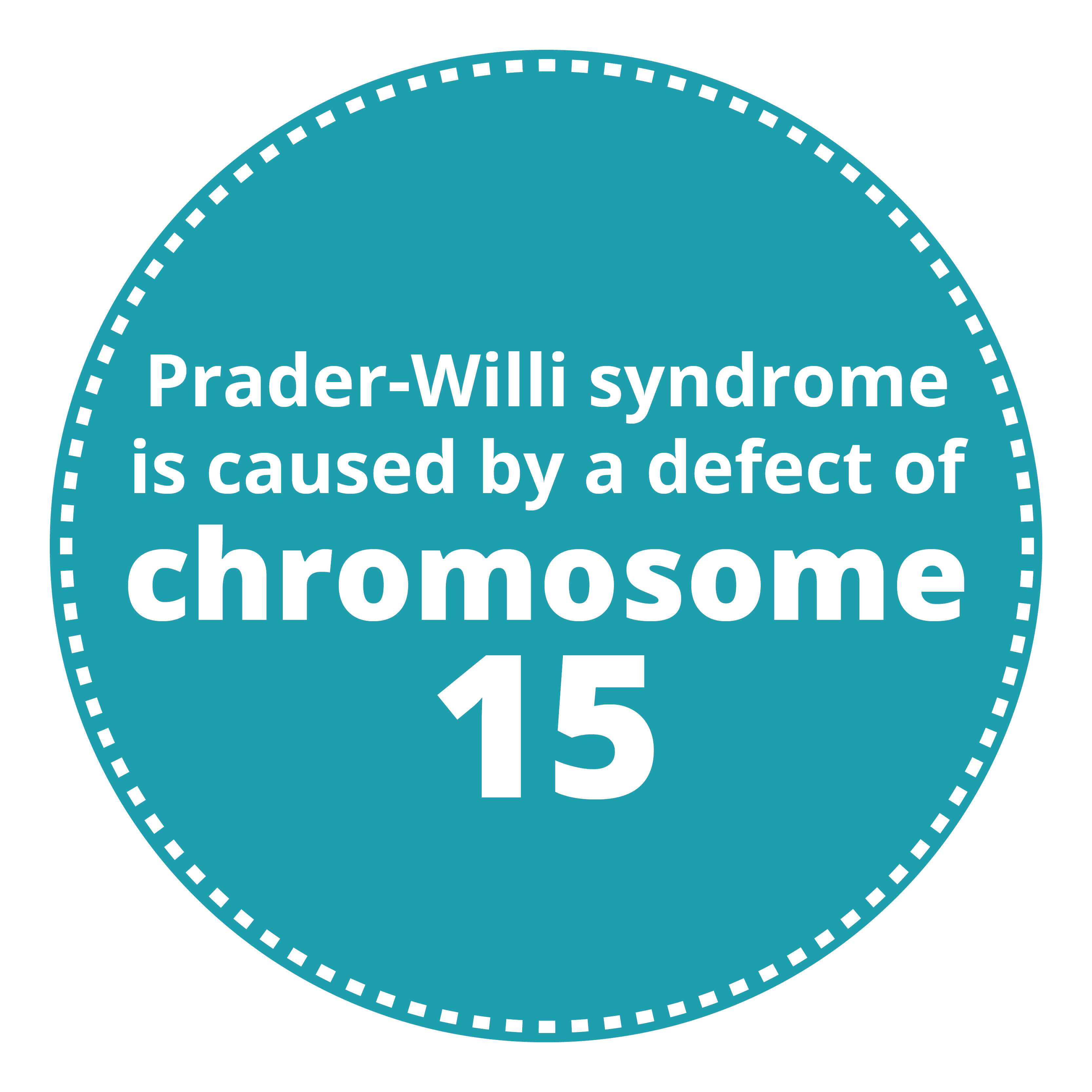Prader Willi Syndrome Adults
